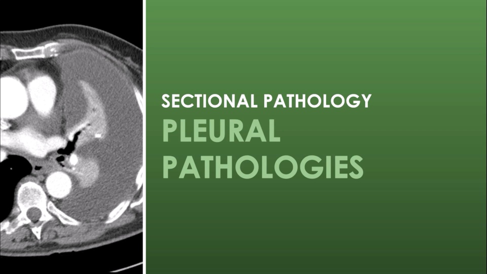 CT Pleural Pathologies | Video Lesson | Clover Learning