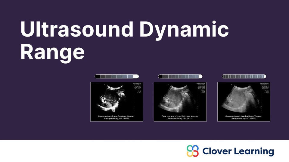 Ultrasound Dynamic Range | Video Lesson | Clover Learning