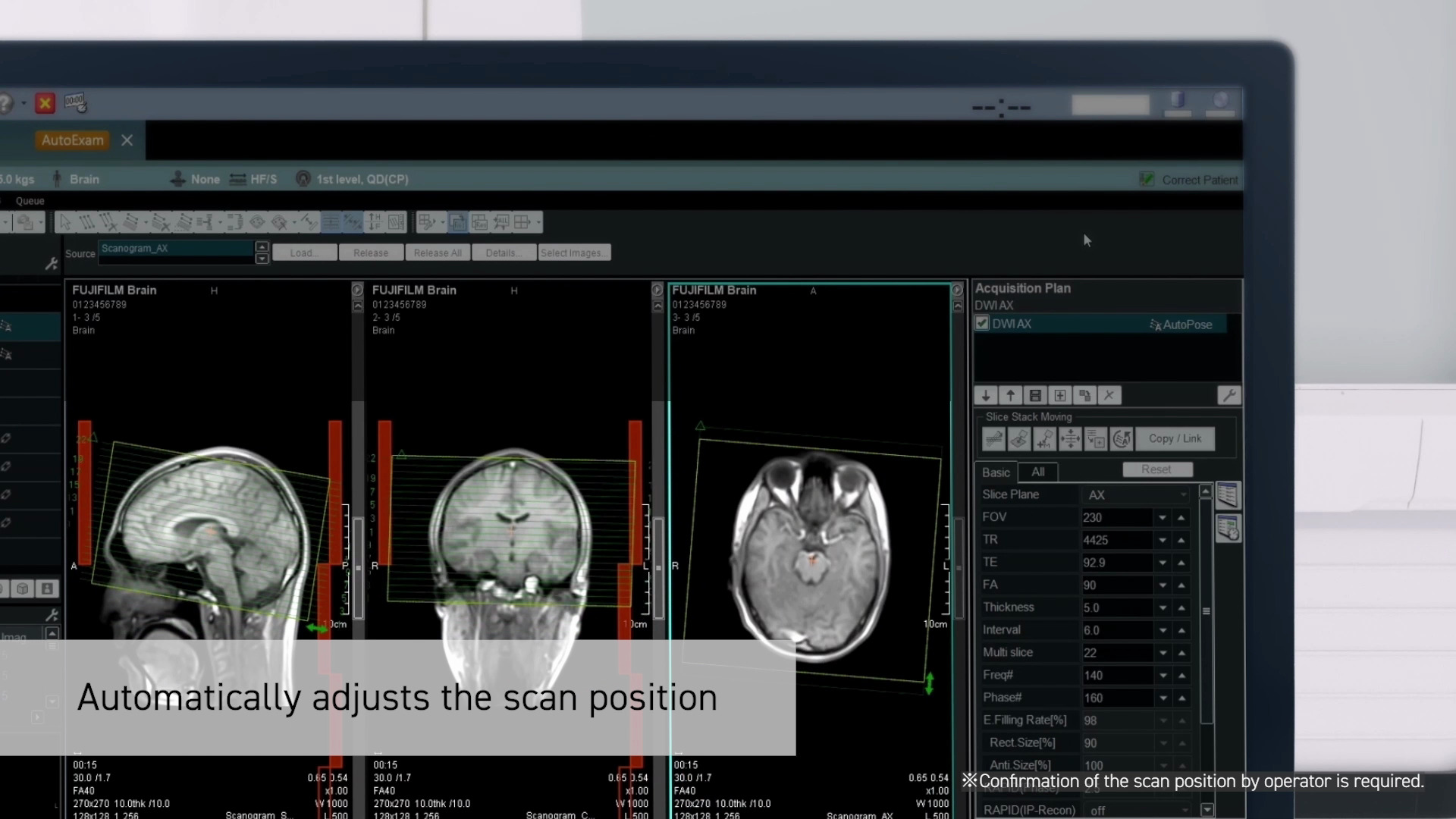 MRI Systems | Trinity Imaging Solutions