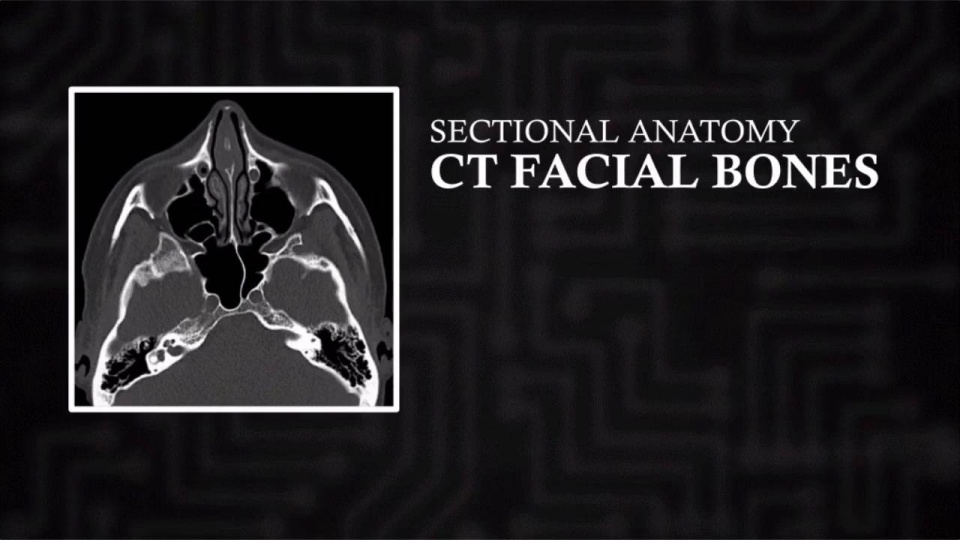 Ct Facial Bones Axial Video Lesson Clover Learning