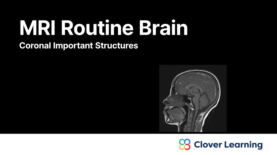 MRI Routine Brain - Important Structures (Coronal) | Video Lesson ...