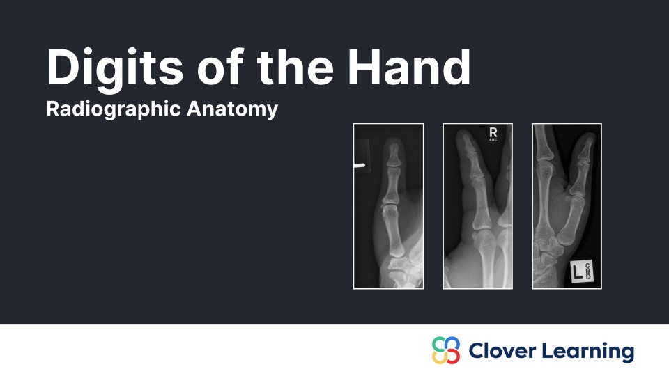 Digits of the Hand: Radiographic Anatomy | Video Lesson | Clover Learning