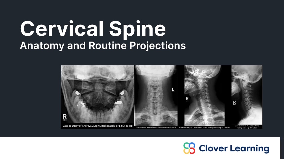 Cervical Spine: Anatomy & Routine Projections | Video Lesson | Clover Learning