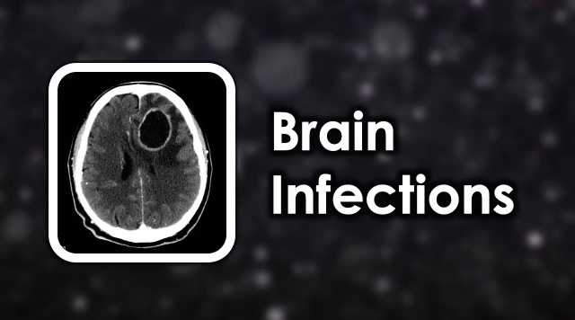 Brain Infections | Video Lesson | Clover Learning