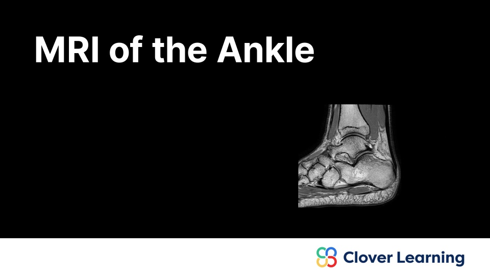 MRI Ankle (Anatomy) | Video Lesson | Clover Learning