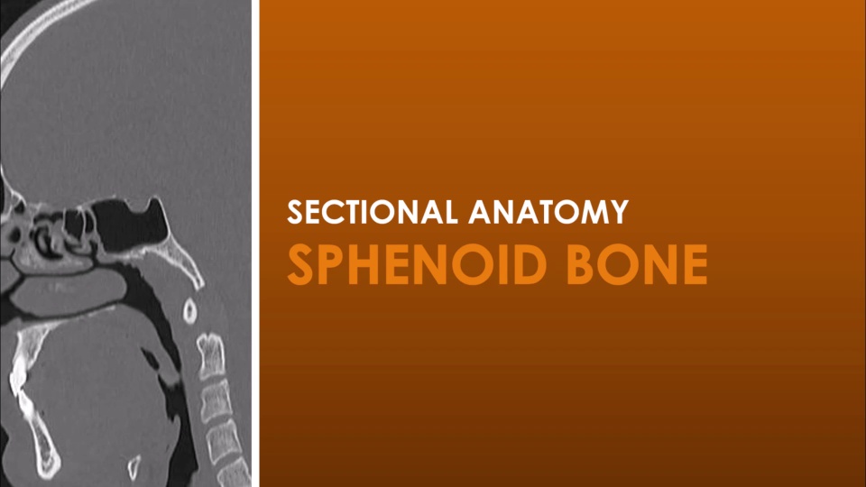 CT Sphenoid Bone | Video Lesson | Clover Learning