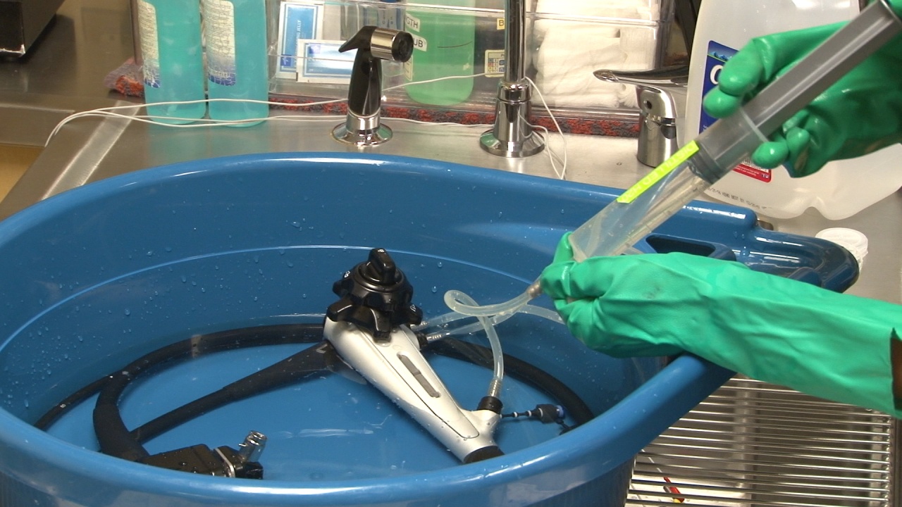 Inspirating Info About How To Clean An Endoscope - Dancelocation19 Inspirating Info About How To Clean An Endoscope - Dancelocation19