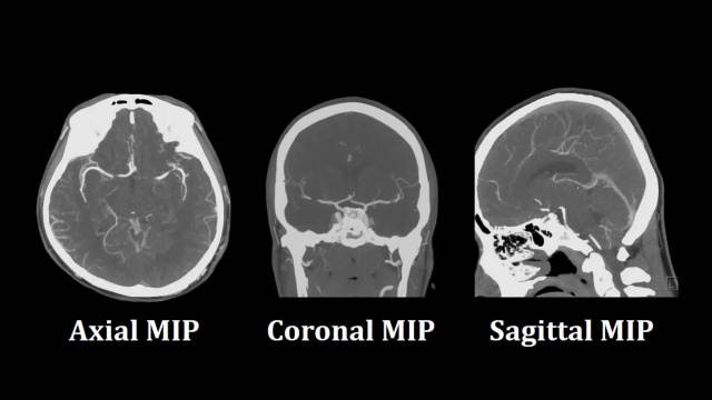 CTA Head | Video Lesson | Clover Learning