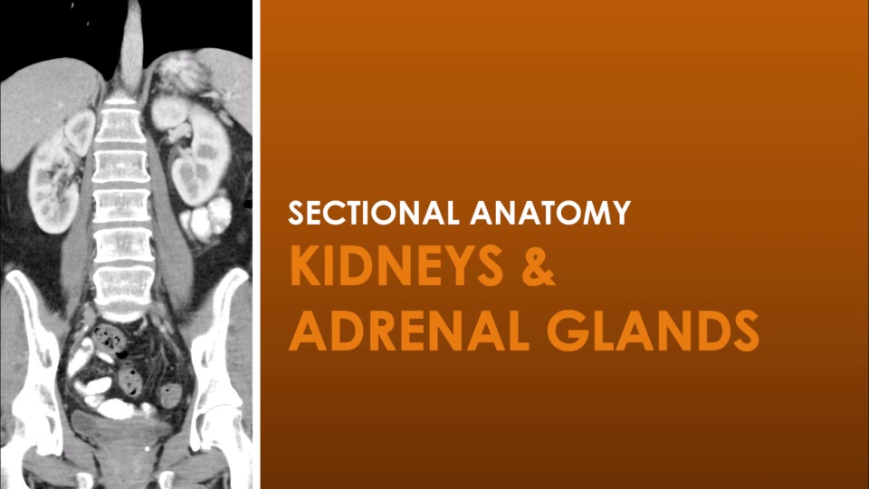 CT Kidneys & Adrenal Glands | Video Lesson | Clover Learning