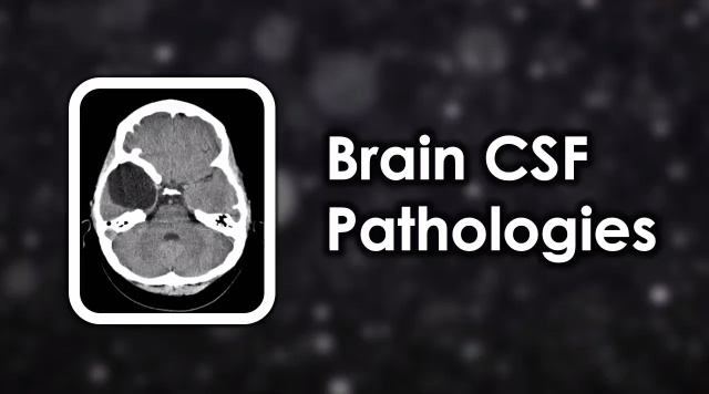 Brain CSF Pathologies | Video Lesson | Clover Learning