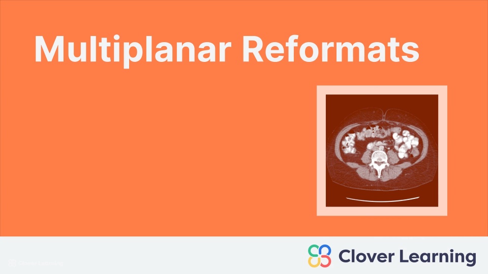 Multiplanar Reformats (MPR) | Video Lesson | Clover Learning