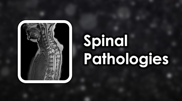Spinal Pathologies | Video Lesson | Clover Learning
