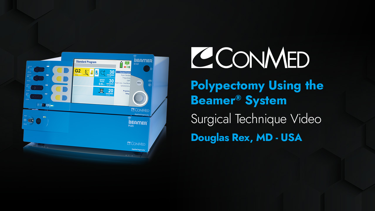 Conmed 6500 Argon Beam Coagulator - The Best Picture Of Beam
