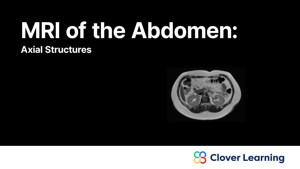 MRI Abdomen Anatomy: Important Structures (Axial) | Video Lesson ...