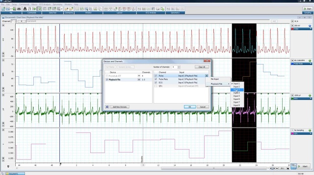 LabChart Videos | ADInstruments