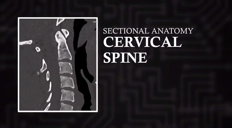 CT Cervical (Sagittal) | Video Lesson | Clover Learning