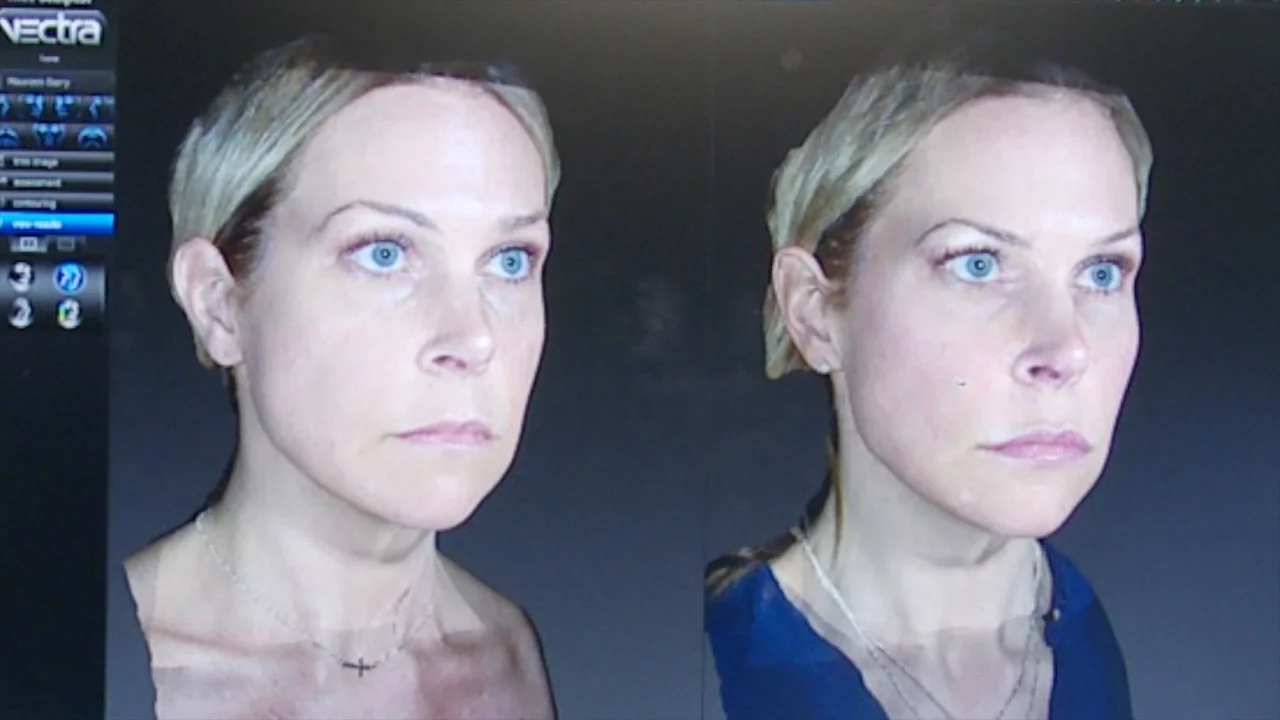 Fighting Gravity Faces