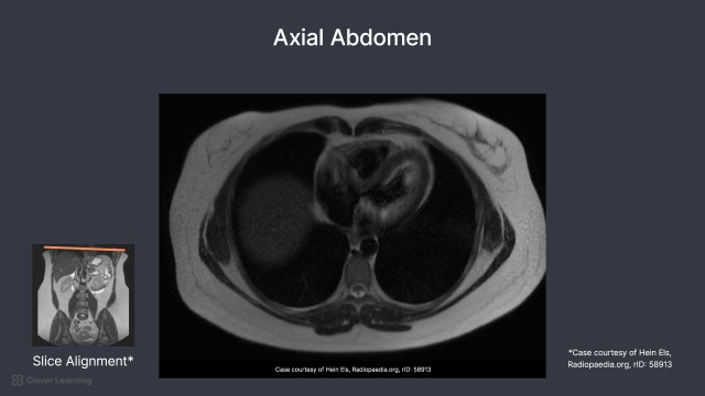 Abdomen Anatomy Mri Abdomen Axial Anatomy Free Cross Sectional