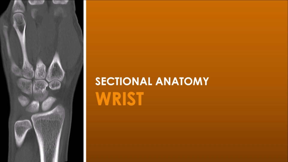 CT Wrist | Video Lesson | Clover Learning