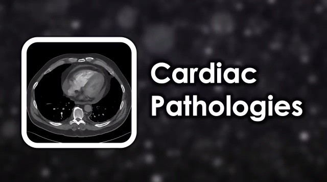 Cardiac Pathologies | Video Lesson | Clover Learning
