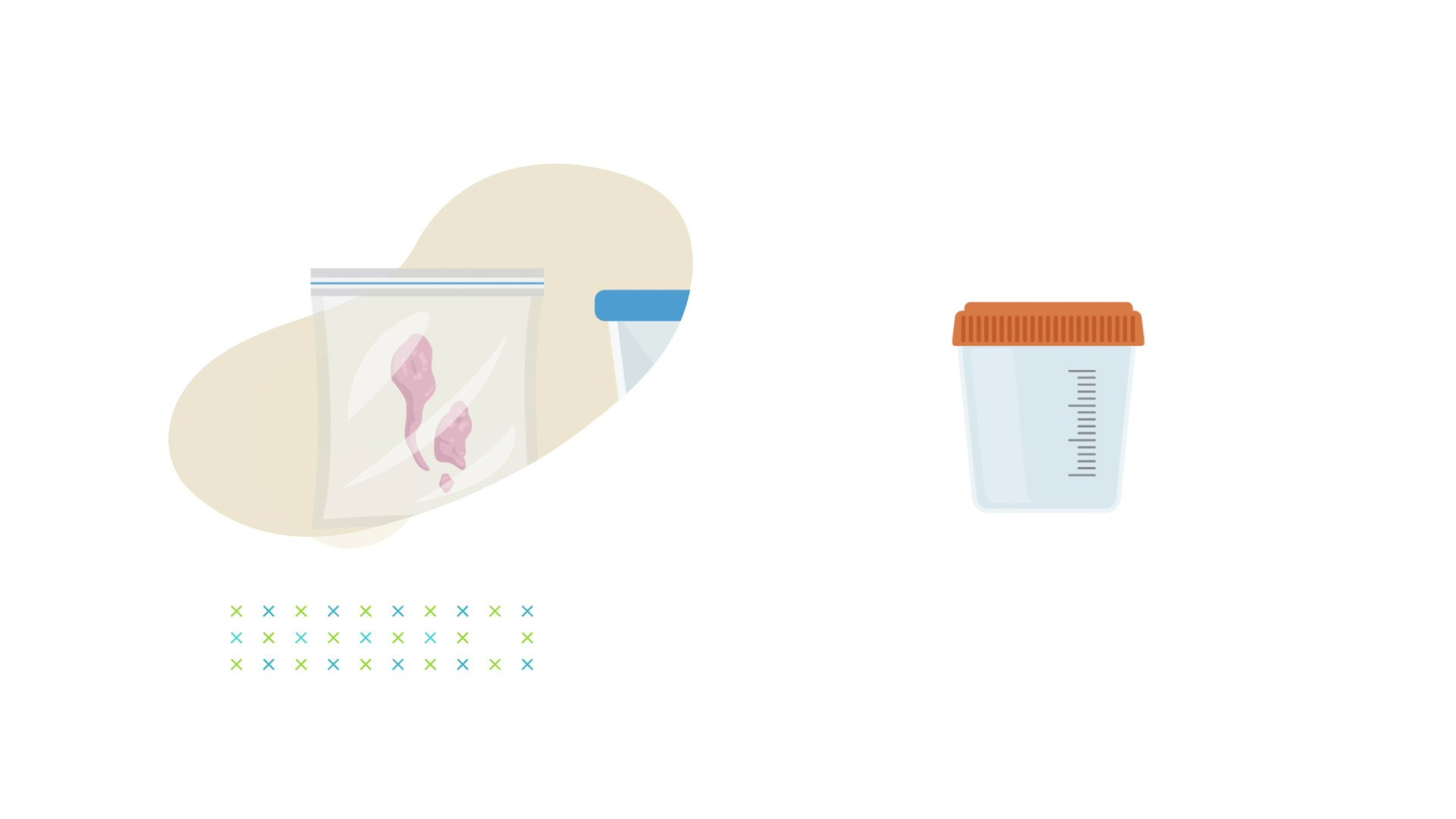 Anora At-Home Collection Instructions