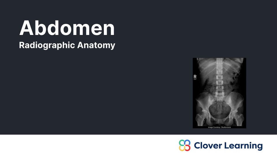 Abdomen: Radiographic Anatomy | Video Lesson | Clover Learning