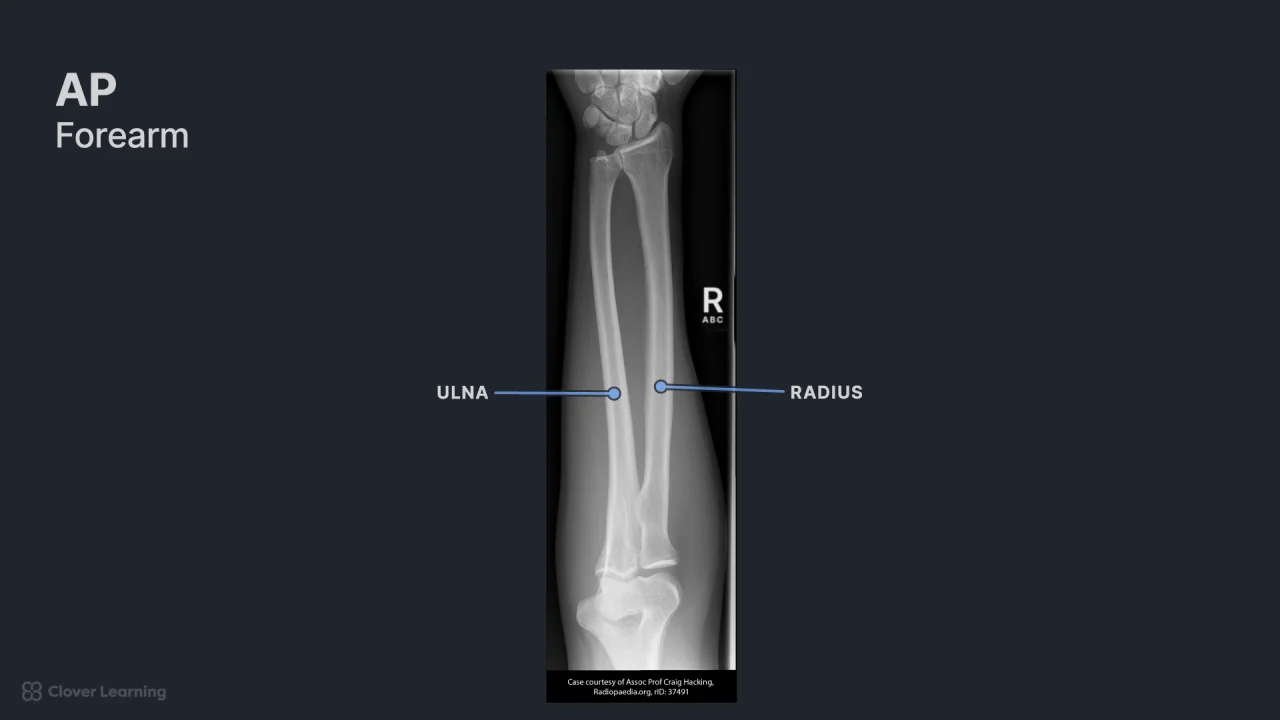 Radiographic Anatomy Of The Forearm Radiology Student
