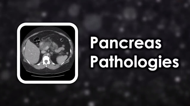 Pancreas Pathologies | Video Lesson | Clover Learning