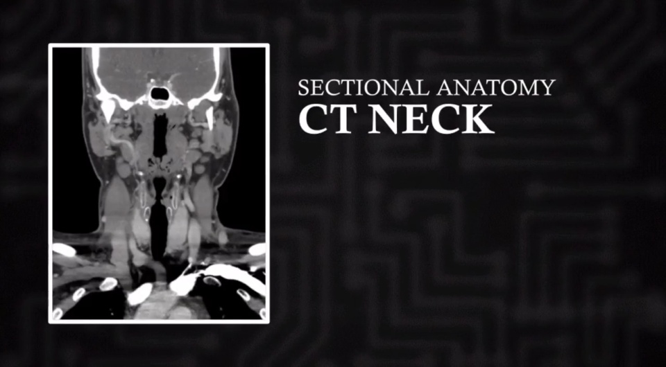 CT Neck (Coronal) | Video Lesson | Clover Learning