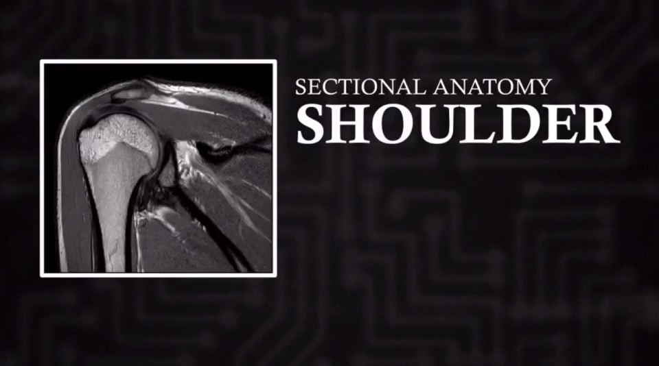 MRI Shoulder (Coronal) | Video Lesson | Clover Learning
