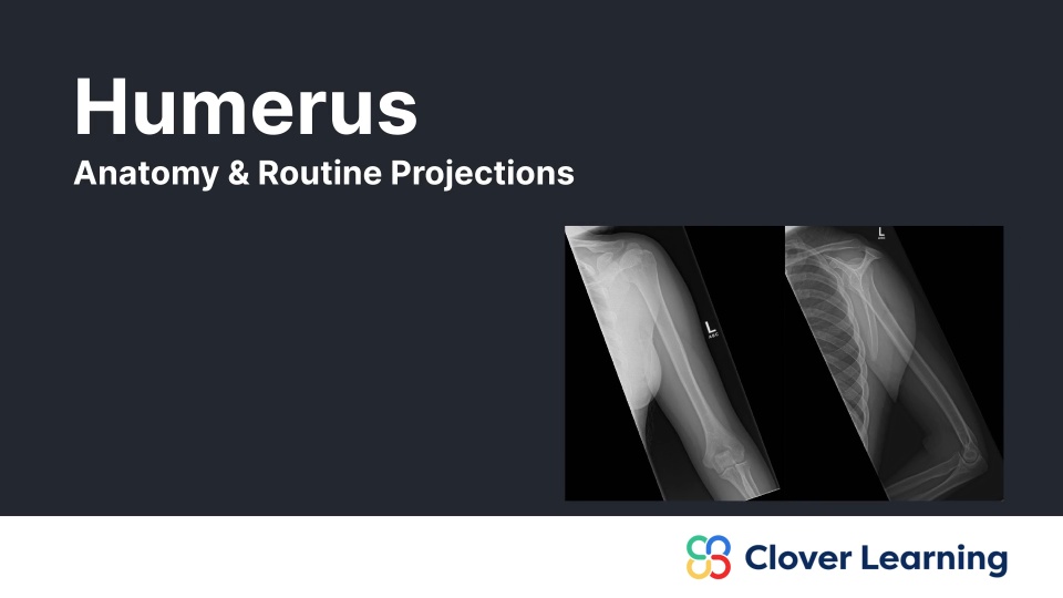 Humerus: Anatomy & Routine Projections | Video Lesson | Clover Learning