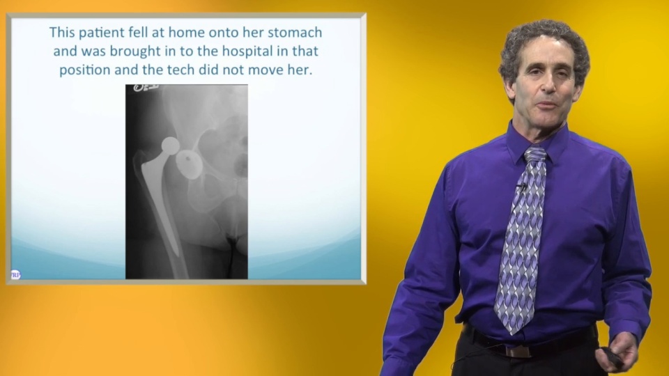 Clements-Nakayama Method | Video Lesson | Clover Learning