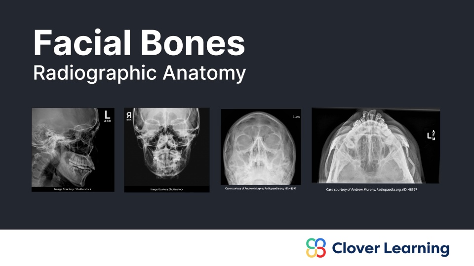 Facial Bones: Radiographic Anatomy | Video Lesson | Clover Learning