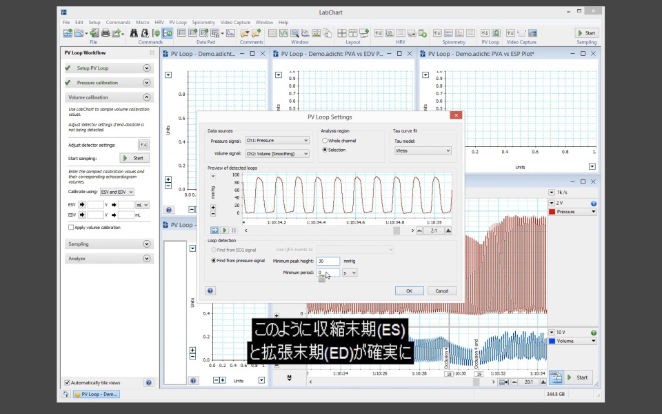Videos | ADInstruments