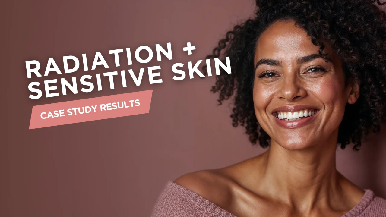 Radiation Side Effects on Sensitive Skin Before and After Photos